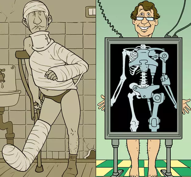 Fracture of some kind of bone - treatment methods