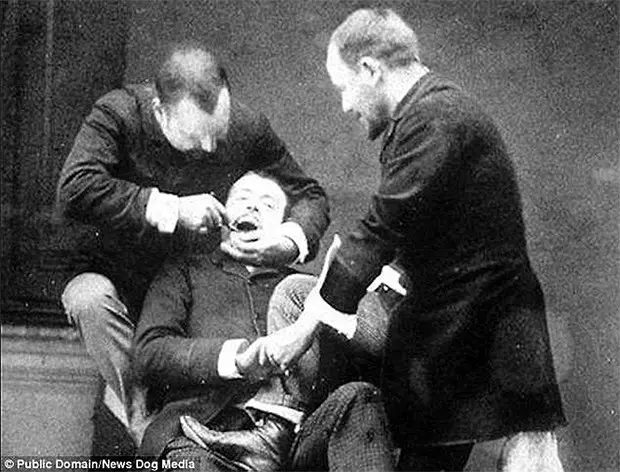 Larawan №4 - Ang Horrors ng Victorian Dentistry: 13 mga larawan nang walang anesthesia