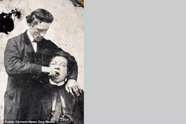 Foto №7 - Horror de la odontología victoriana: 13 fotos sin anestesia