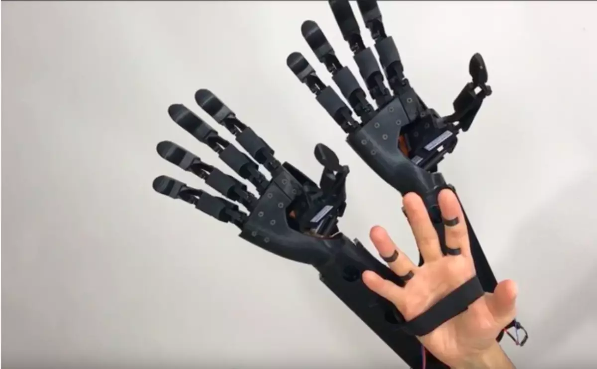 Photo №1 - developed cybernetic prosthesis of two hands instead of one