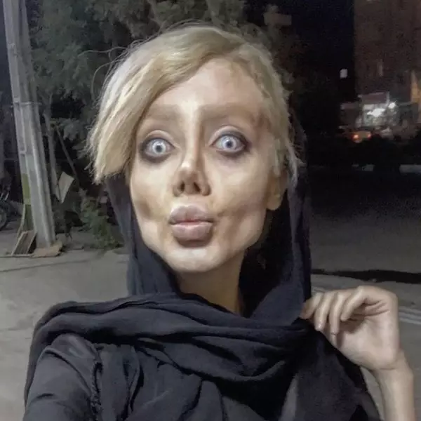 Madanm soti nan Iran te fè 50 operasyon yo vin menm jan ak Angelina Jolie 124977_8