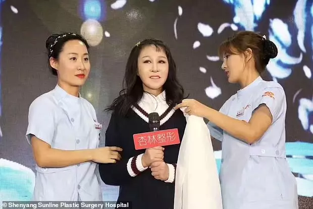 Foto №3 - Gadis Cina kerana penyakit yang jarang berlaku dalam 15 tahun kelihatan seperti seorang wanita tua, tetapi pembedahan plastik tetap semua (foto)