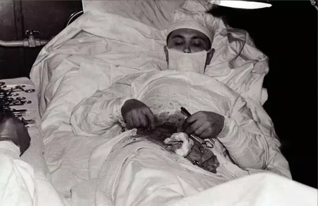 Foto №2 - 5 tregime të pabesueshme për njerëzit që kishin për të bërë një operacion për veten e tyre