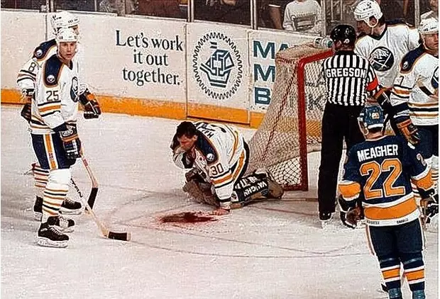 Foto número 6 - Las lesiones más terribles en la historia de los deportes.
