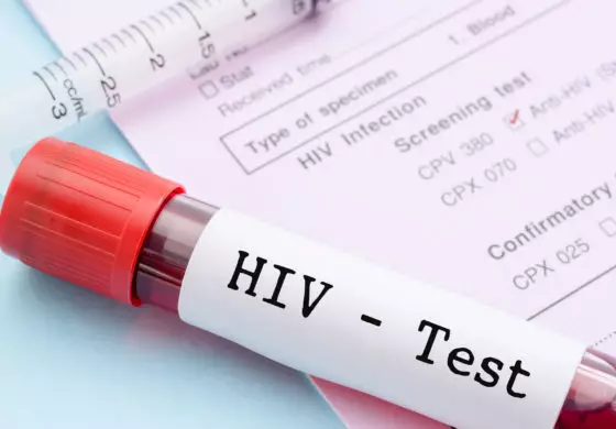 Chithunzi nambala 1 - hiv katemera wa HIV wayesa kwambiri, konzekerani mayesero azachipatala