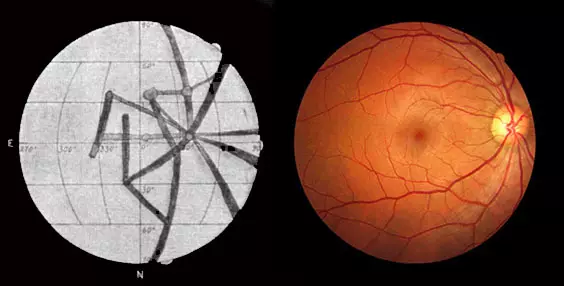 Bilde №3 - som en astronom percival lowell så mystiske nåler på Venus og hva de endte opp